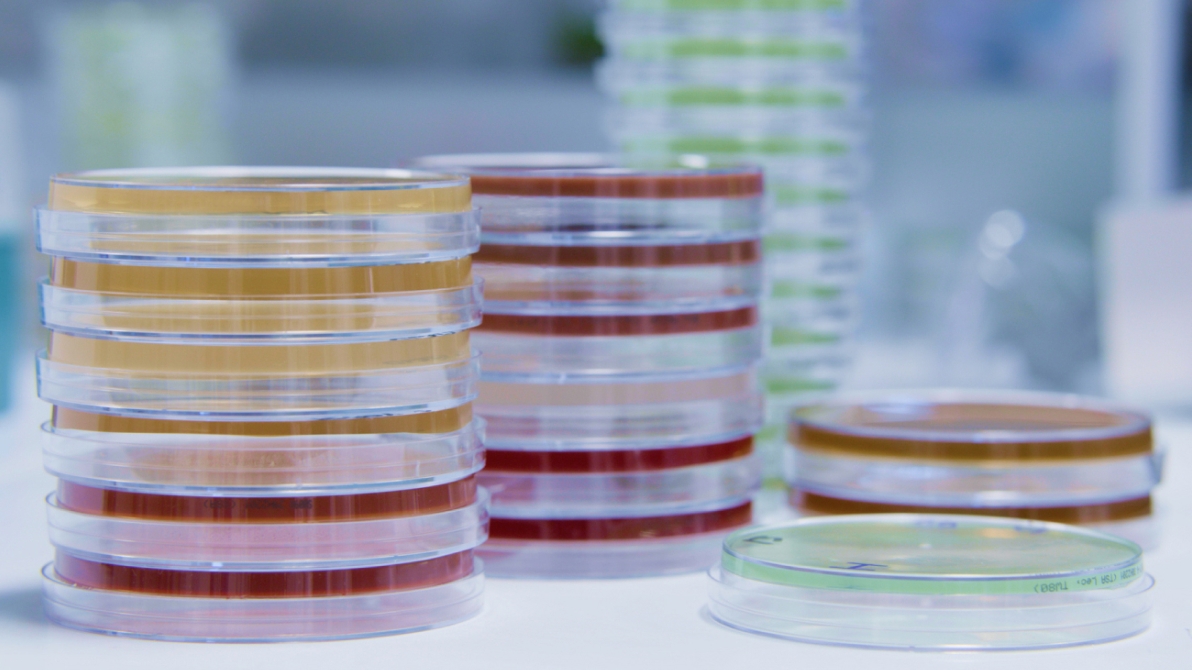 Agar Plates
